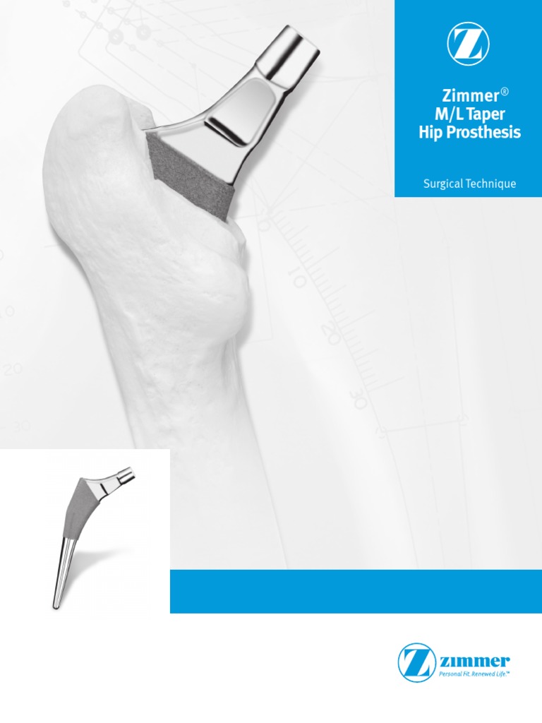 Zimmer ML Taper Hip Prosthesis Surgical Technique | PDF | Hip | Human ...