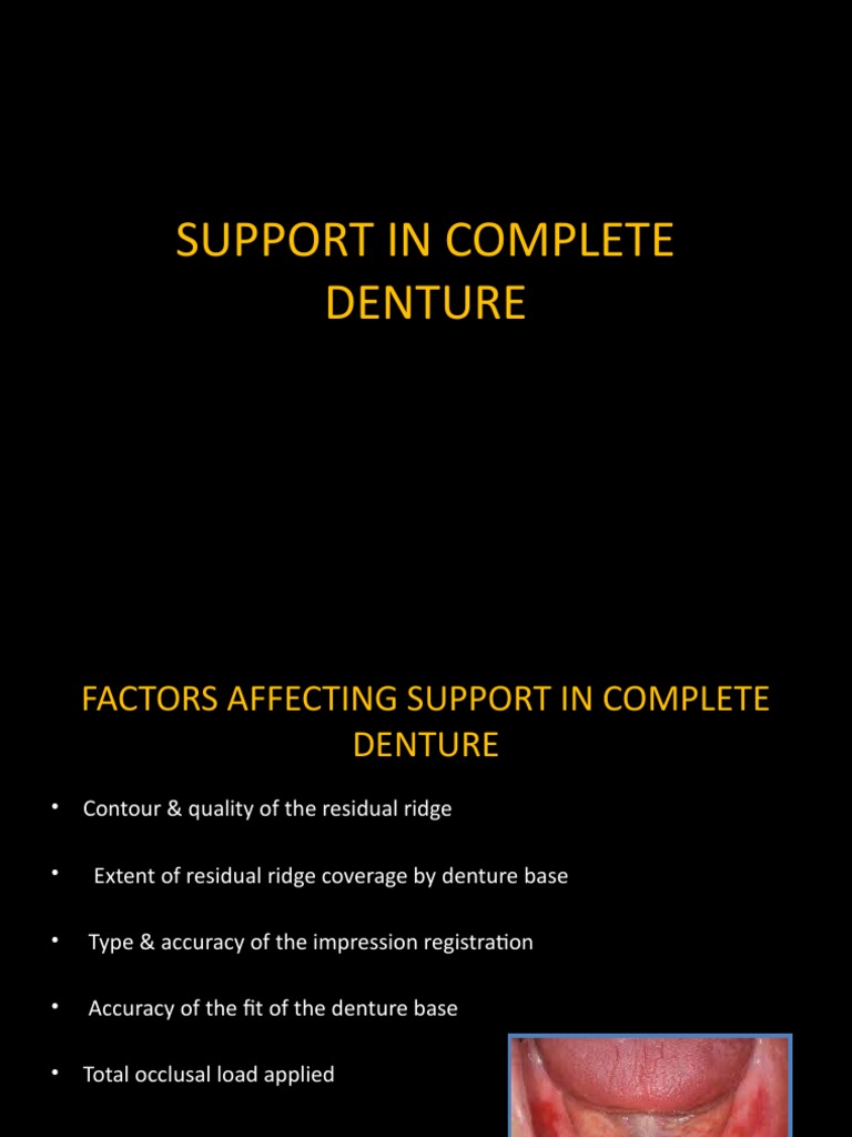 Support in Complete Denture | Download Free PDF | Dentures | Bone