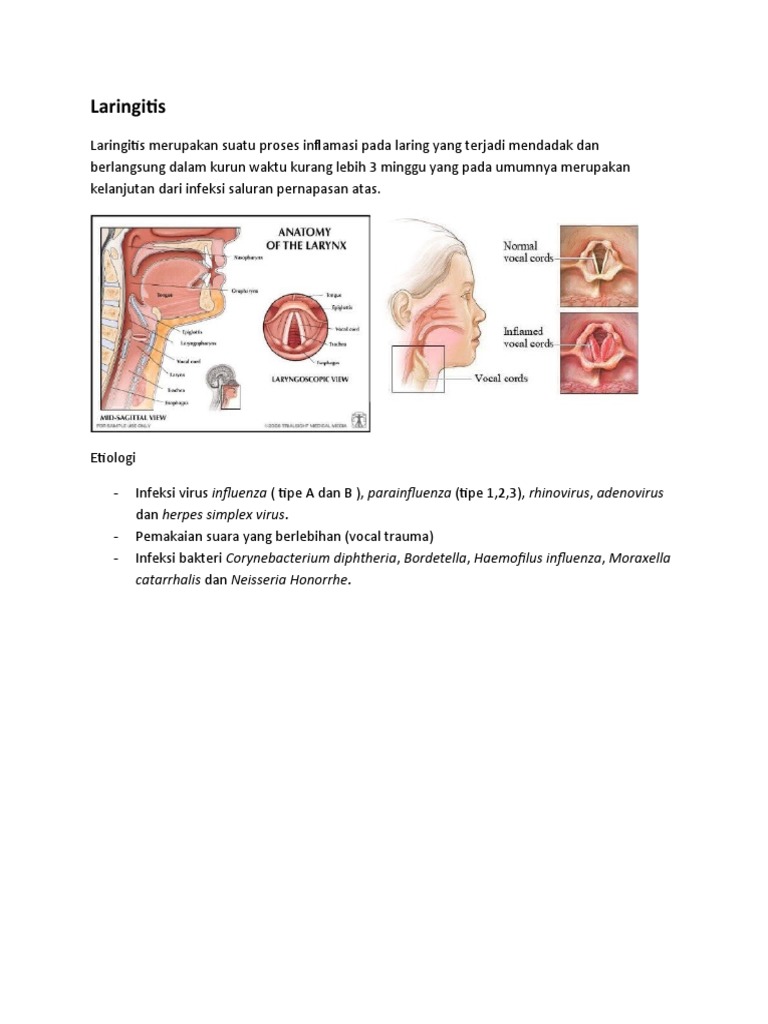 Etiologi dan Terapi Laringitis Akut | PDF | Pengembangan Diri ...