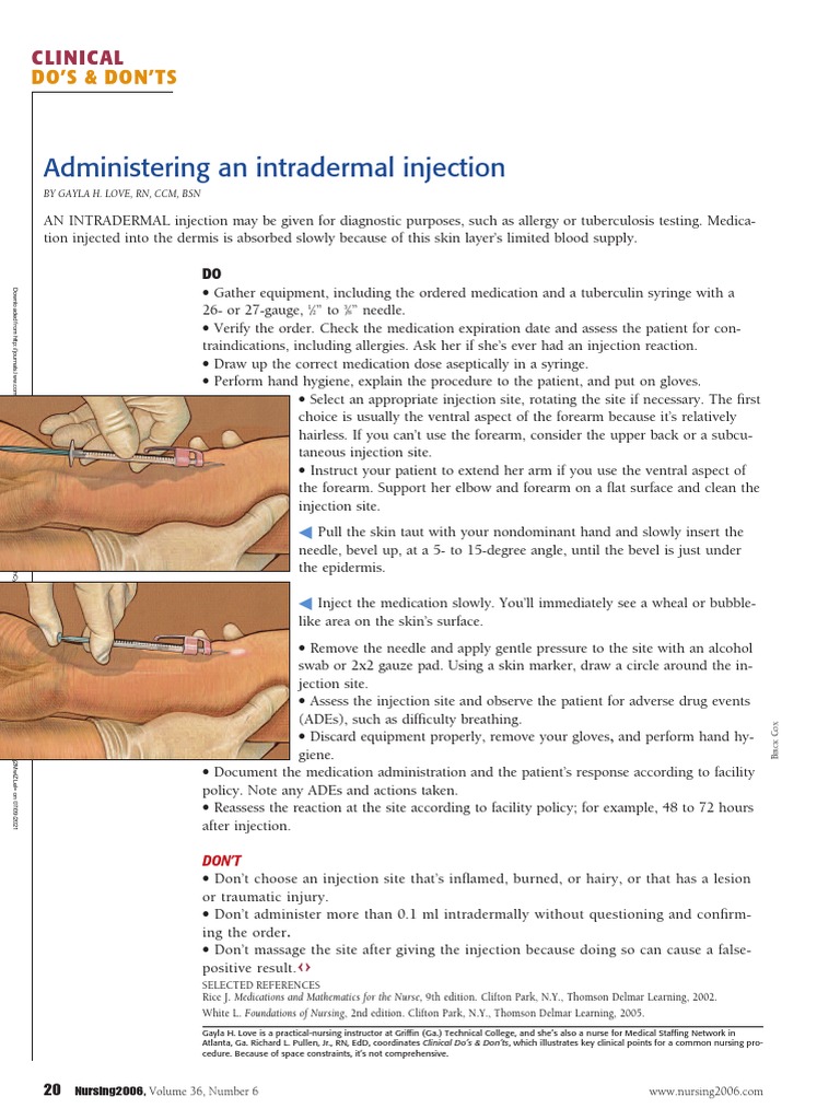 Administering An Intradermal Injection.16 | Download Free PDF ...