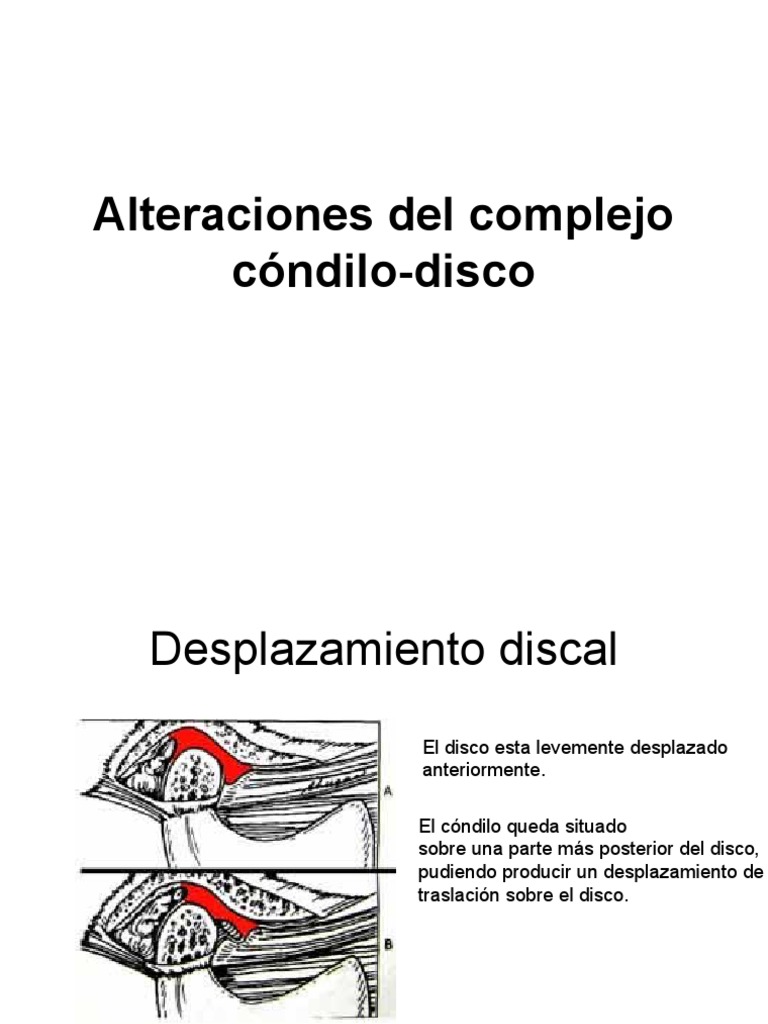 Alteraciones Del Complejo Cóndilo-Disco | PDF | Ciencia y matemáticas