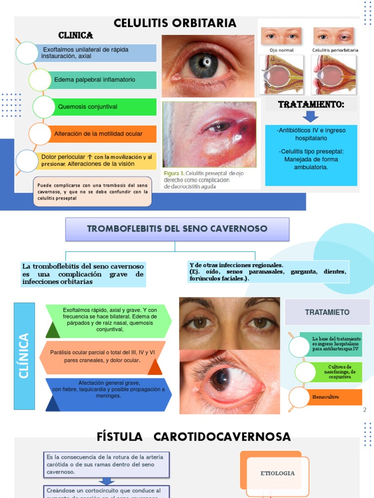 Celulitis Orbitaria | PDF | Inmunología | Enfermedades y trastornos