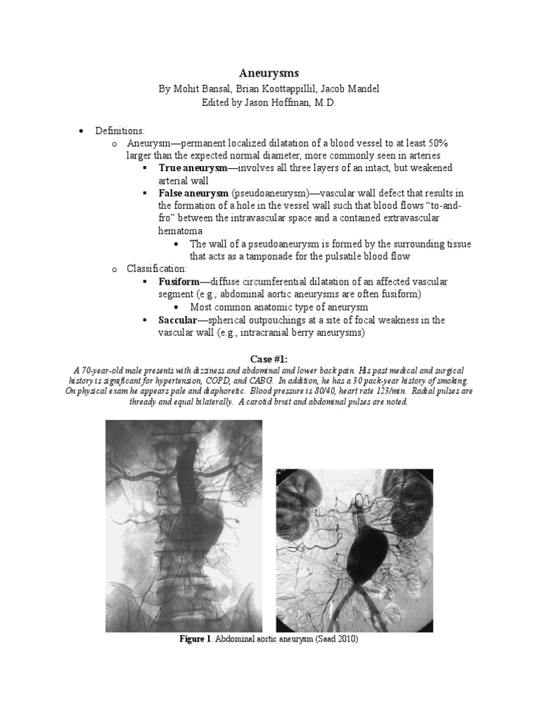 Aneurysms | PDF | Interventional Radiology | Aorta
