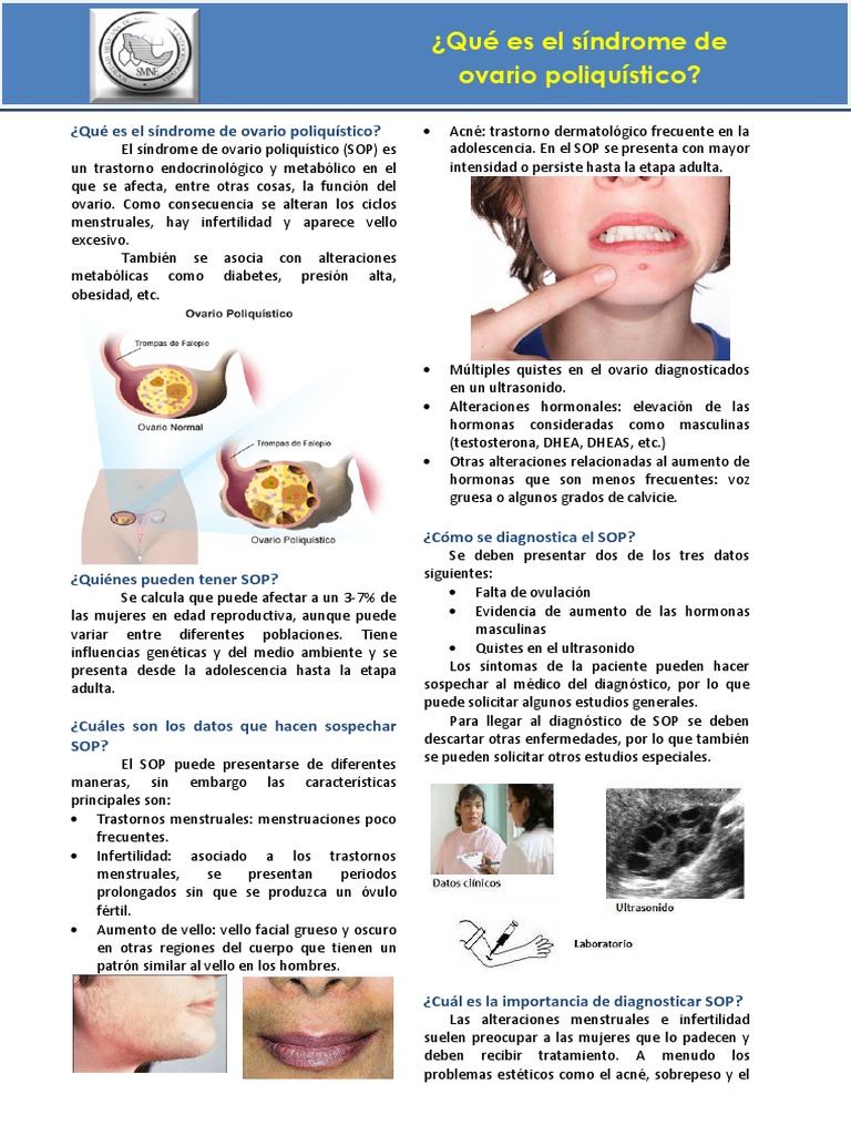 Síndrome de Ovario Poliquístico: Guía Completa | PDF | Sindrome de ...