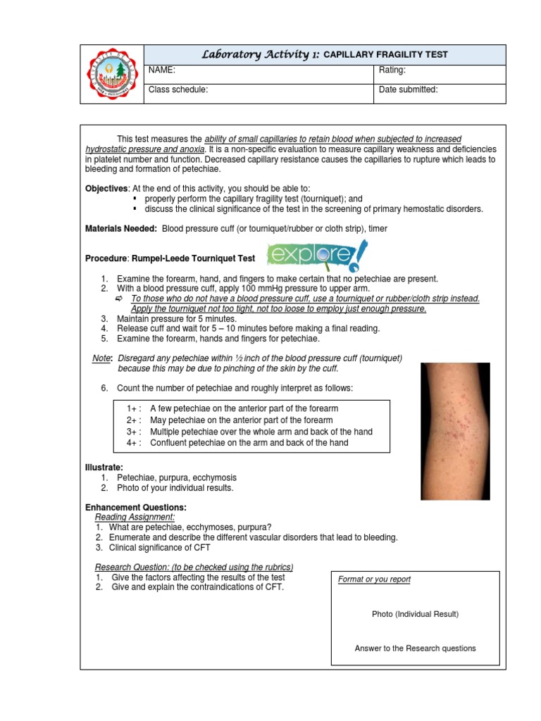 Laboratory Activity 1:: Capillary Fragility Test | PDF | Blood Pressure ...