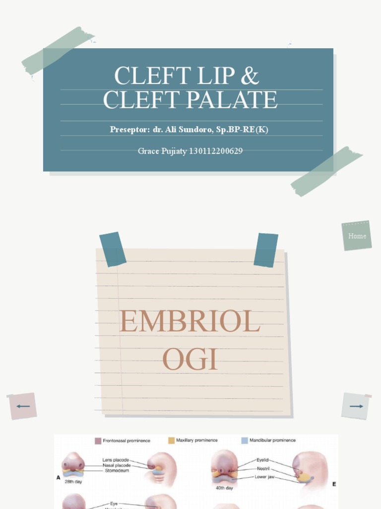 Cleft Lip and Palate Overview | PDF | Lip | Face