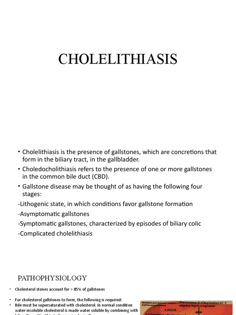 CHOLELITHIASIS | PDF | Gallbladder | Bile