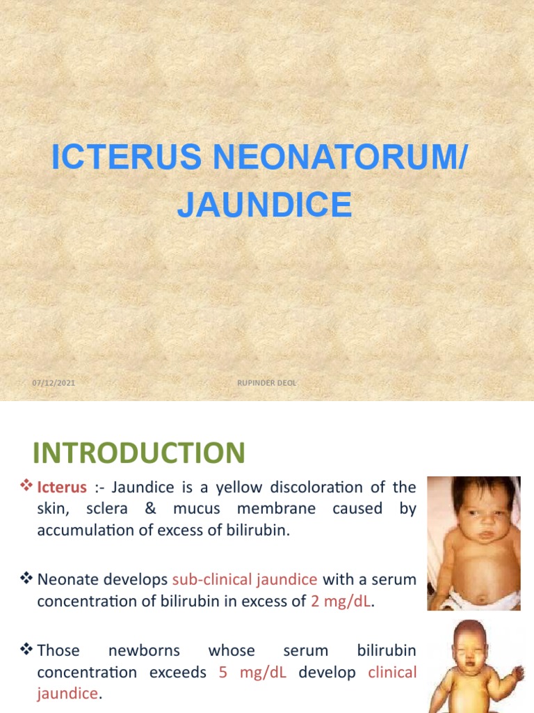 Icterus Neonatorum/ Jaundice: 07/12/2021 Rupinder Deol | PDF | Clinical ...