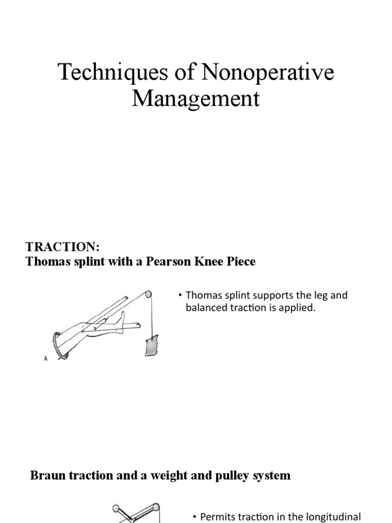 Techniques of Nonoperative Management | PDF
