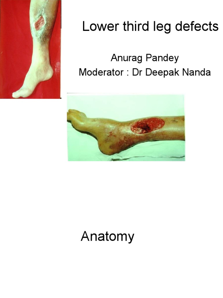 Lower Third Leg Defects: Anurag Pandey Moderator: DR Deepak Nanda | PDF ...