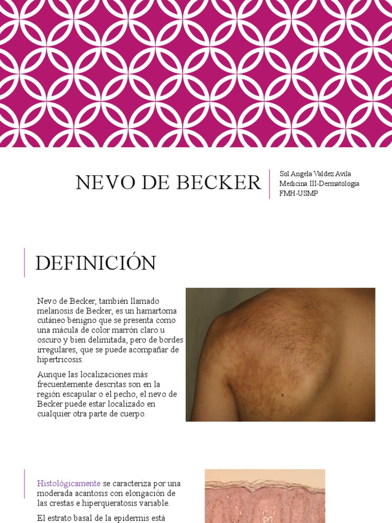 Nevo de Becker | PDF | Piel | Sistema endocrino