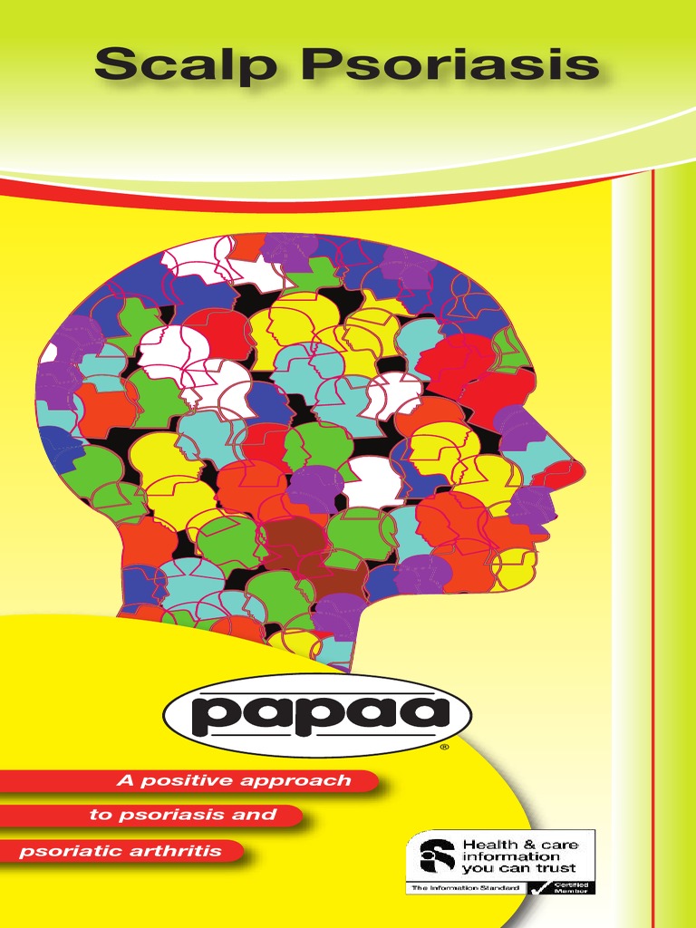 Scalp Psoriasis | PDF | Psoriasis | Topical Medication