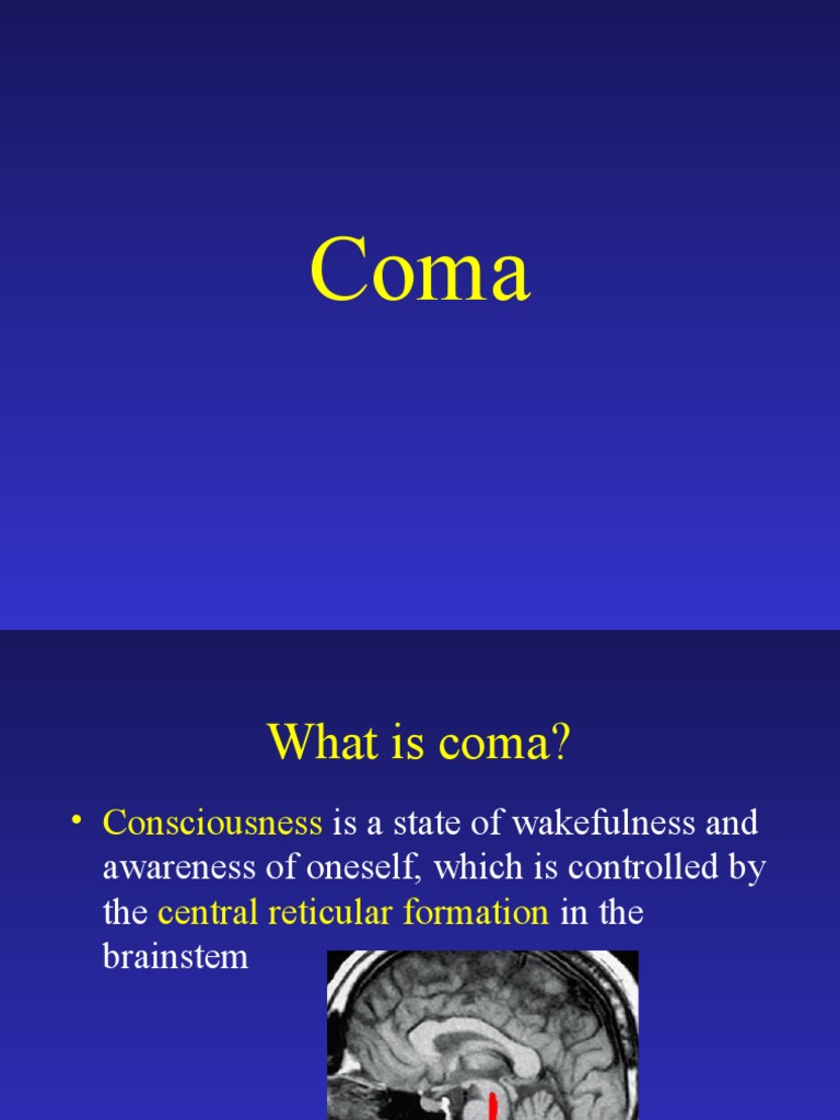Coma | PDF | Coma | Meningitis
