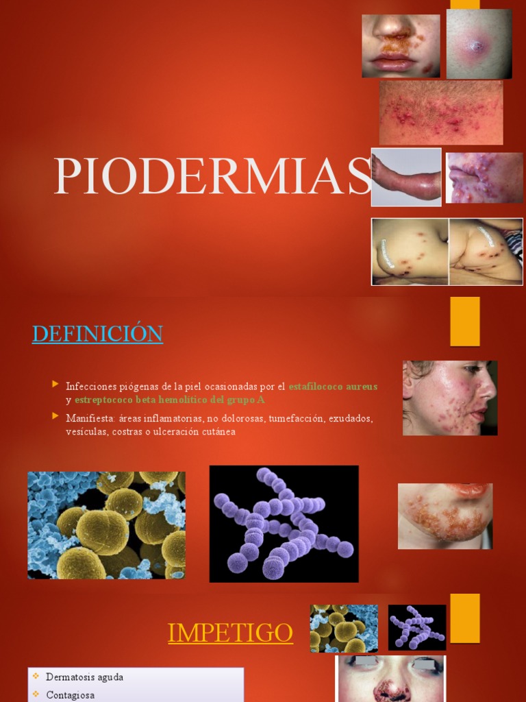 PIODERMIAS | PDF | Piel | Especialidades Medicas