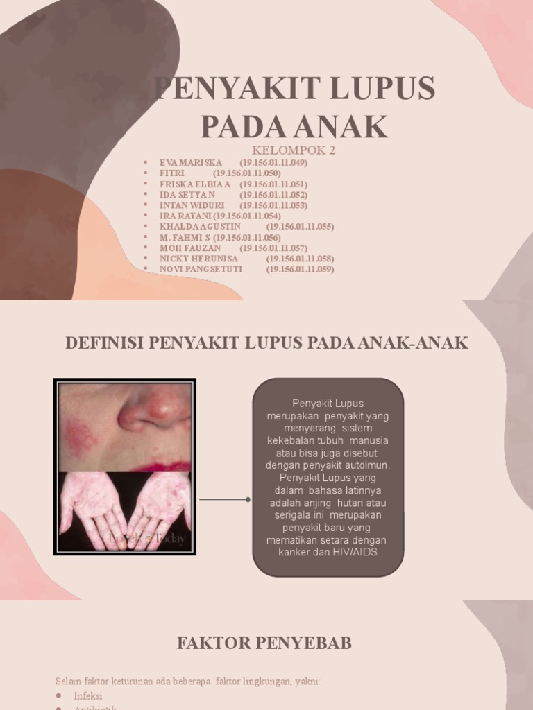 Gejala dan Risiko Lupus pada Anak | PDF