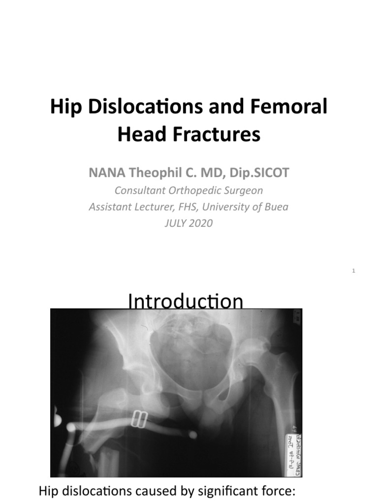 Hip Disloc and Fem Head | PDF | Hip | Anatomical Terms Of Motion