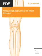 Brochure Acufex | PDF | Knife | Knee