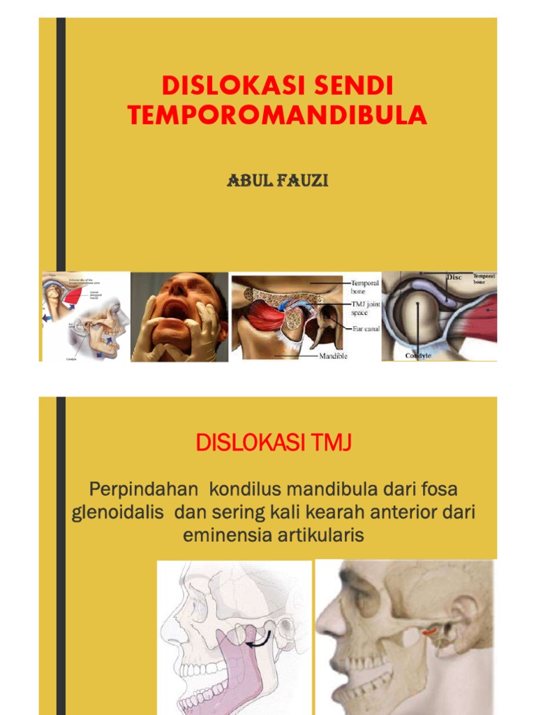 Dislokasi Mandibula | PDF