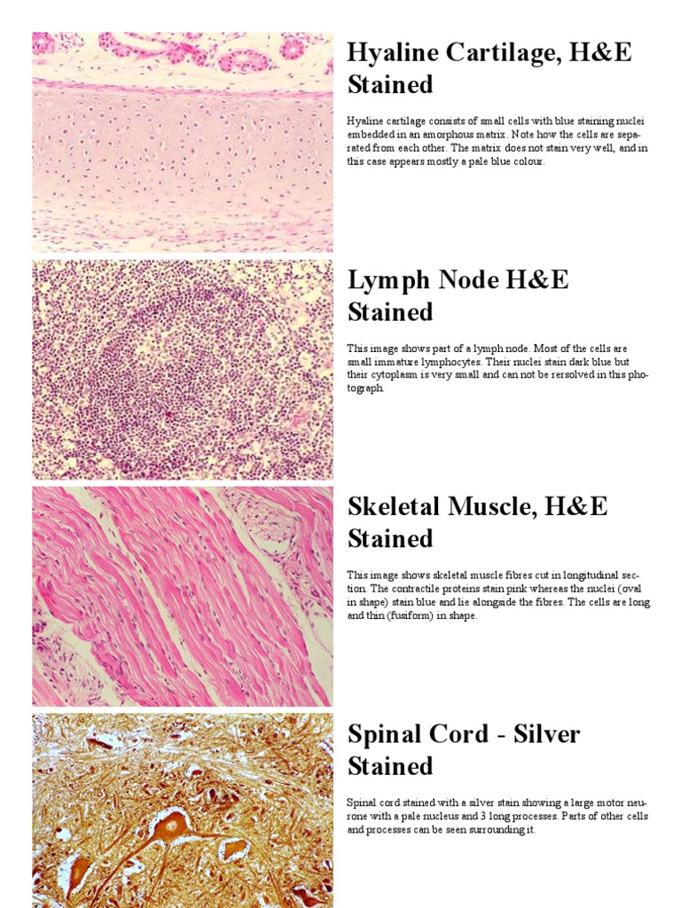 histology-important-notes-epithelium-lung