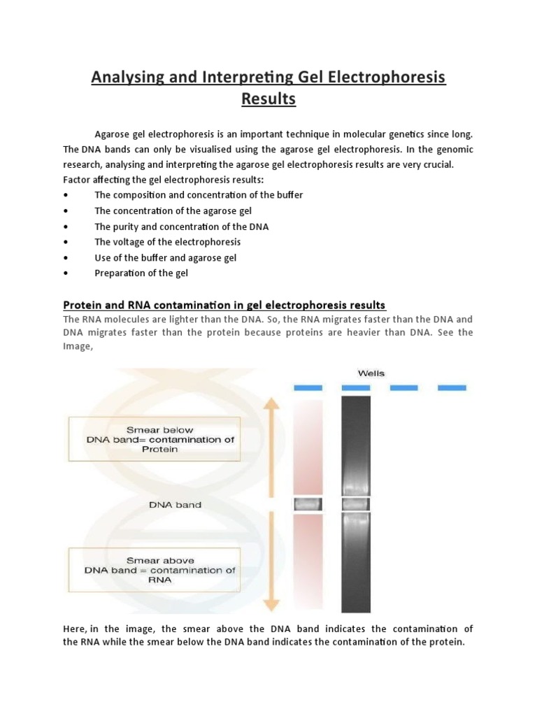 Electrophoresis Results