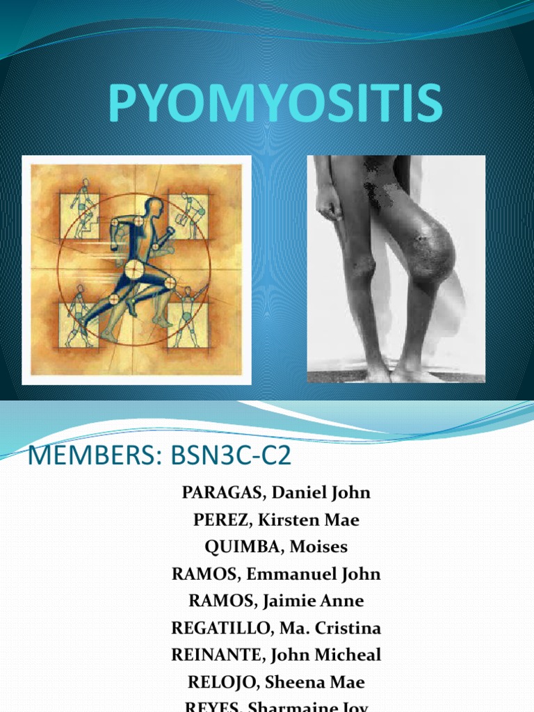 Pyomyositis Ca1 | PDF | Human Leg | Pelvis