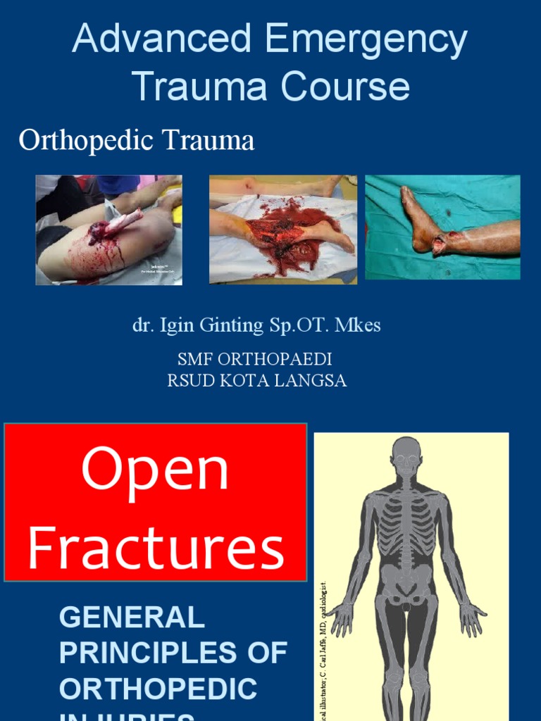 Advanced Emergency Trauma Course Orthopedic Trauma Injuries | PDF | Hip ...