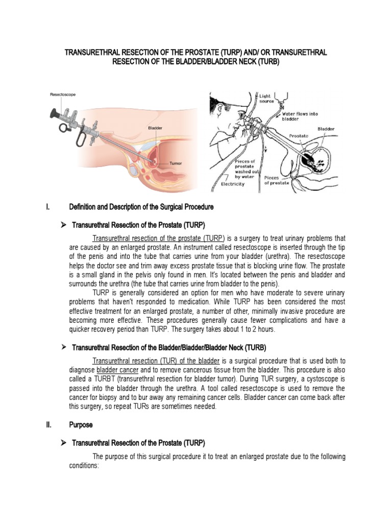 Minimally Invasive Procedures for Urinary Problems: Transurethral ...