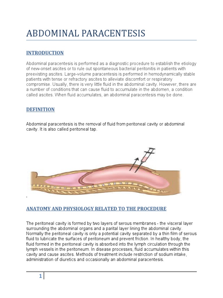 Abdominal Paracentesis Procedure Purposes Nursing Care