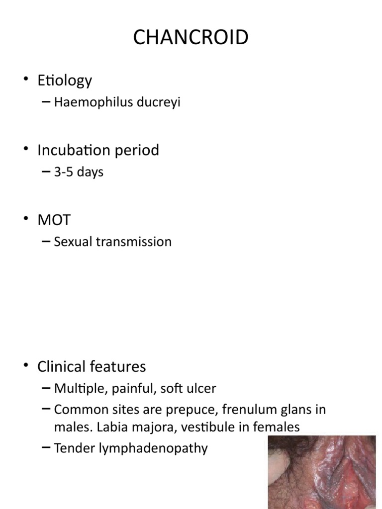 Chancroid Gonorrhoea Chkamydia | PDF