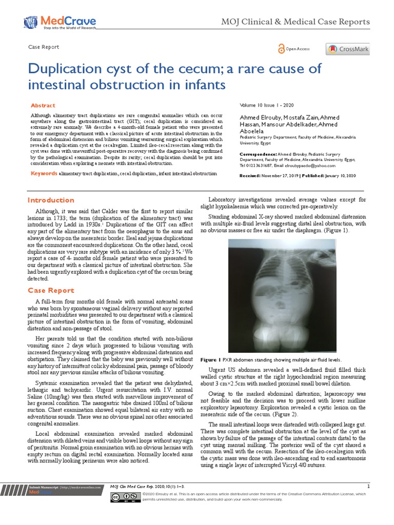 Duplication Cyst of The Cecum | PDF | Gastrointestinal Tract ...
