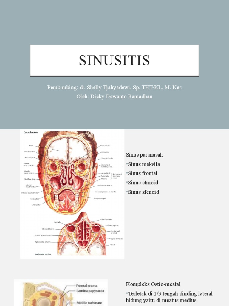 Sinusitis: Diagnosis dan Terapi | PDF | Sains & Matematika