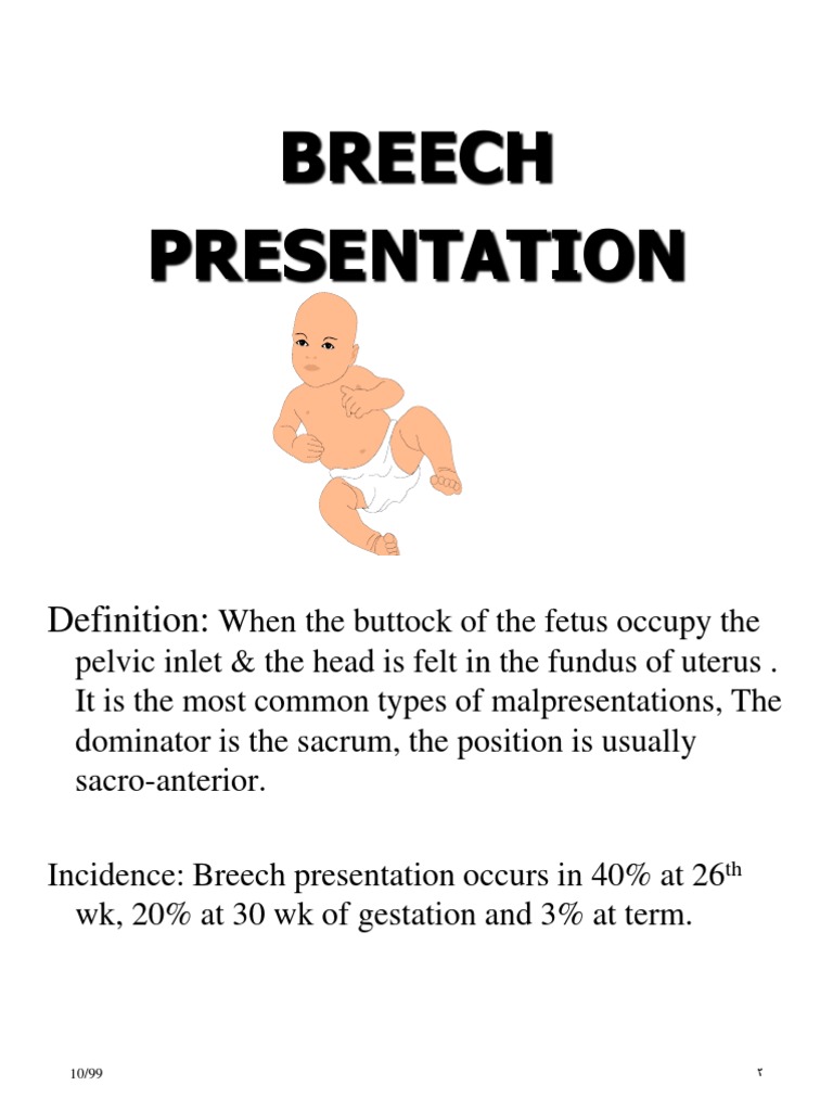 Breech-Presentation (2) - 1 | PDF | Fetus | Childbirth