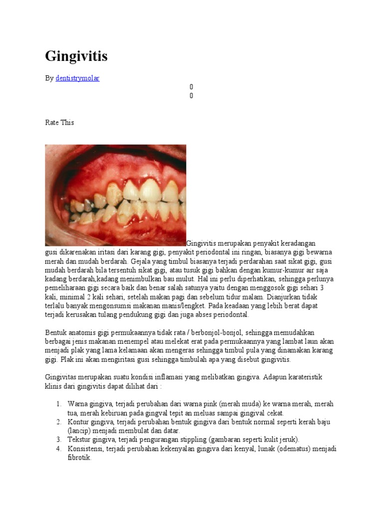 Panduan Gingivitis untuk Pasien | PDF