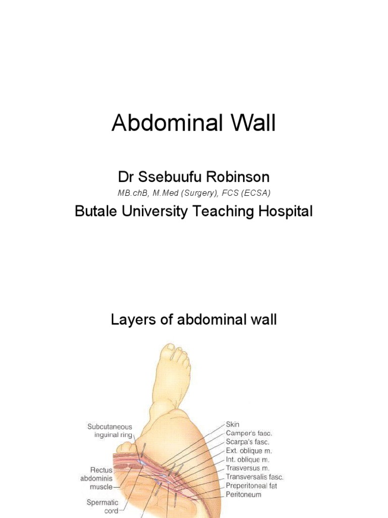 Abdominal Wall: DR Ssebuufu Robinson Butale University Teaching ...