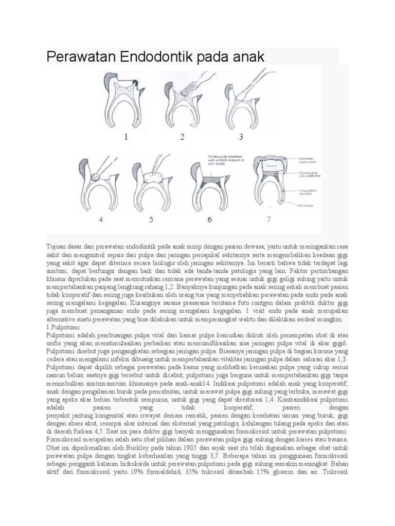 Perawatan Endodontik Pada Anak | PDF