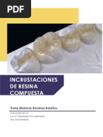 Comparativa de Coronas Metal Porcelana | PDF | Odontología | Materiales