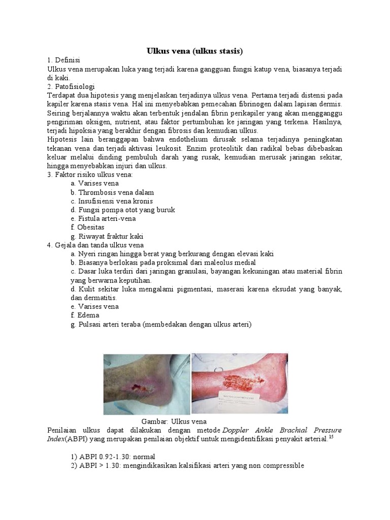 Ulcus Venalis | PDF