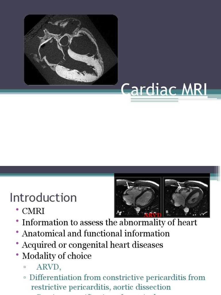 CMRI | Download Free PDF | Heart | Cardiac Muscle