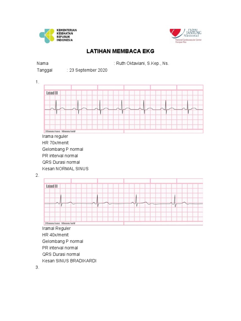Latihan Membaca Ekg | PDF