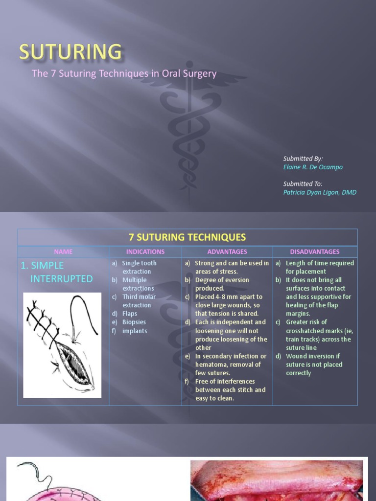 SUTURING TECHNIQUES-AssignVersion | PDF | Surgical Suture | Dental Implant
