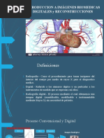 Pitch y TC Helicoidal | PDF | Ct Scan