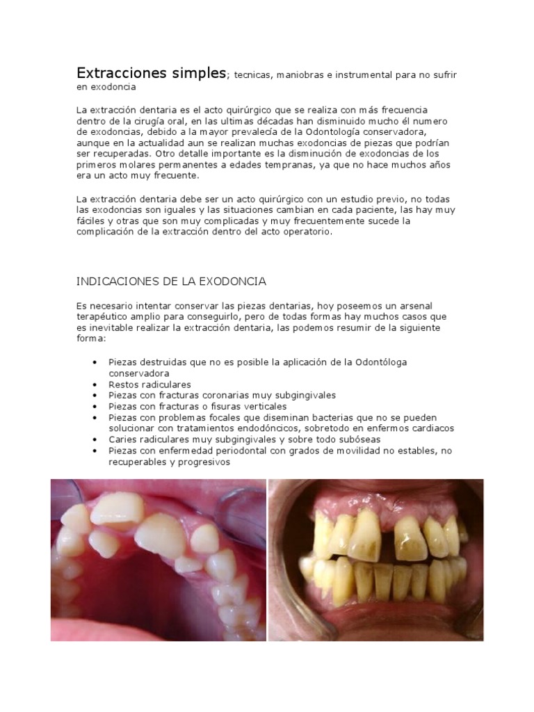 Extracciones simples | Especialidades médicas | Boca