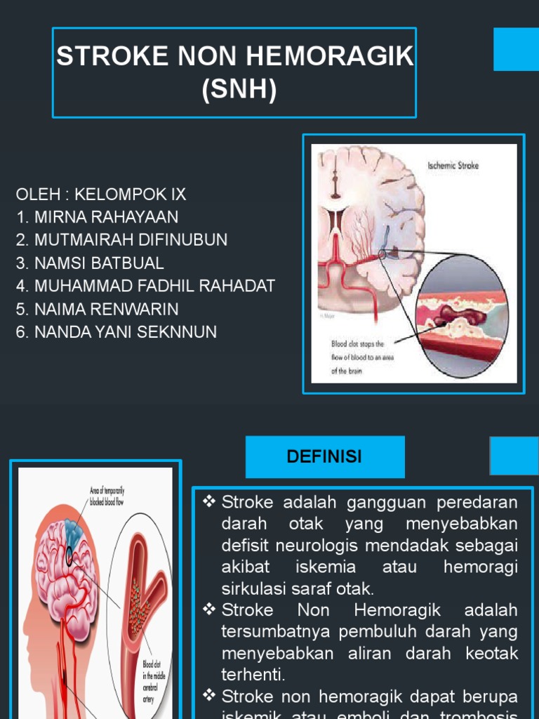 Materi Seminar Stroke | PDF