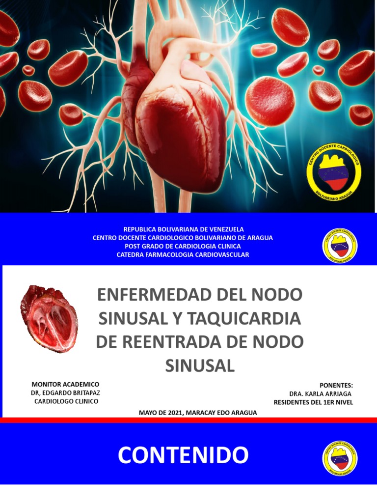 Enf Nodo Sinusal | PDF | Sistema cardiovascular | Arritmia cardiaca