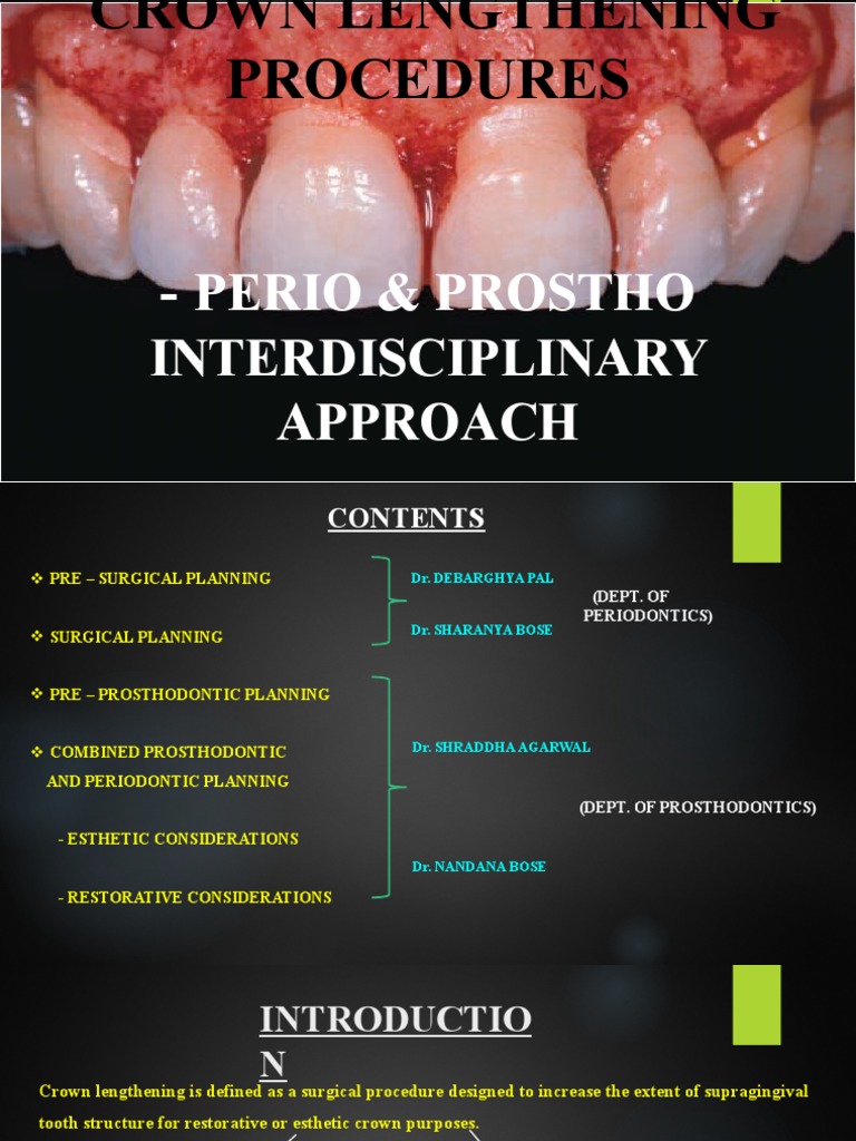 Interdisciplinary Seminar - CLP | PDF | Periodontology | Face