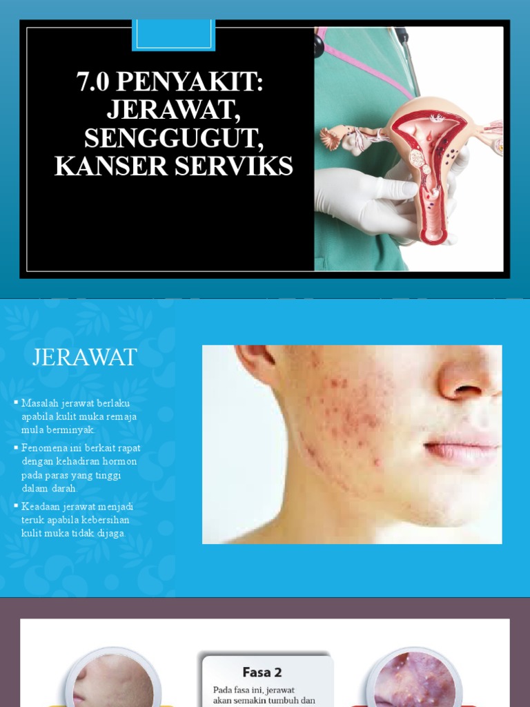 PJPK T1 Unit 8 - 7.0 Penyakit (Jerawat, Senggugut, Kanser Serviks | PDF