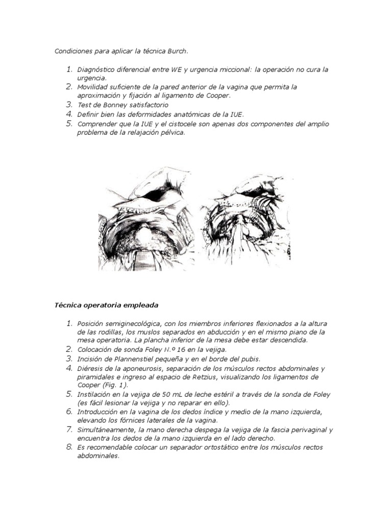 Condiciones para Aplicar La Técnica Burch | PDF | Osteoporosis | Efecto ...