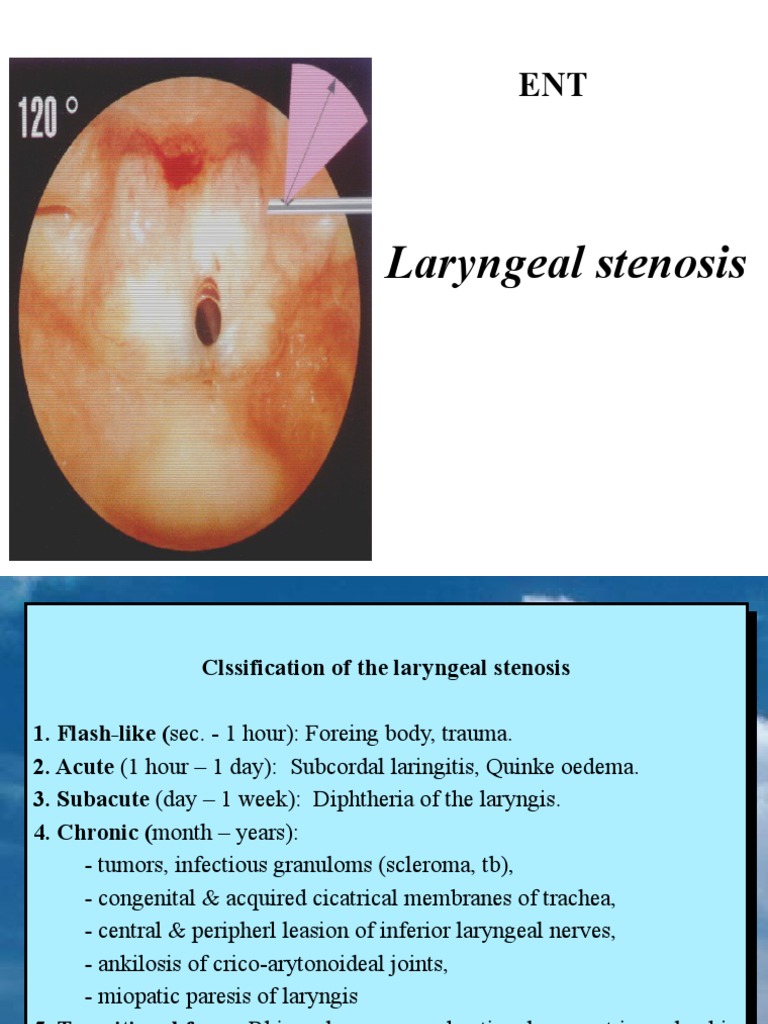 Stenosis, Scleroma, Tracheostomy | PDF | Diseases And Disorders | Anatomy