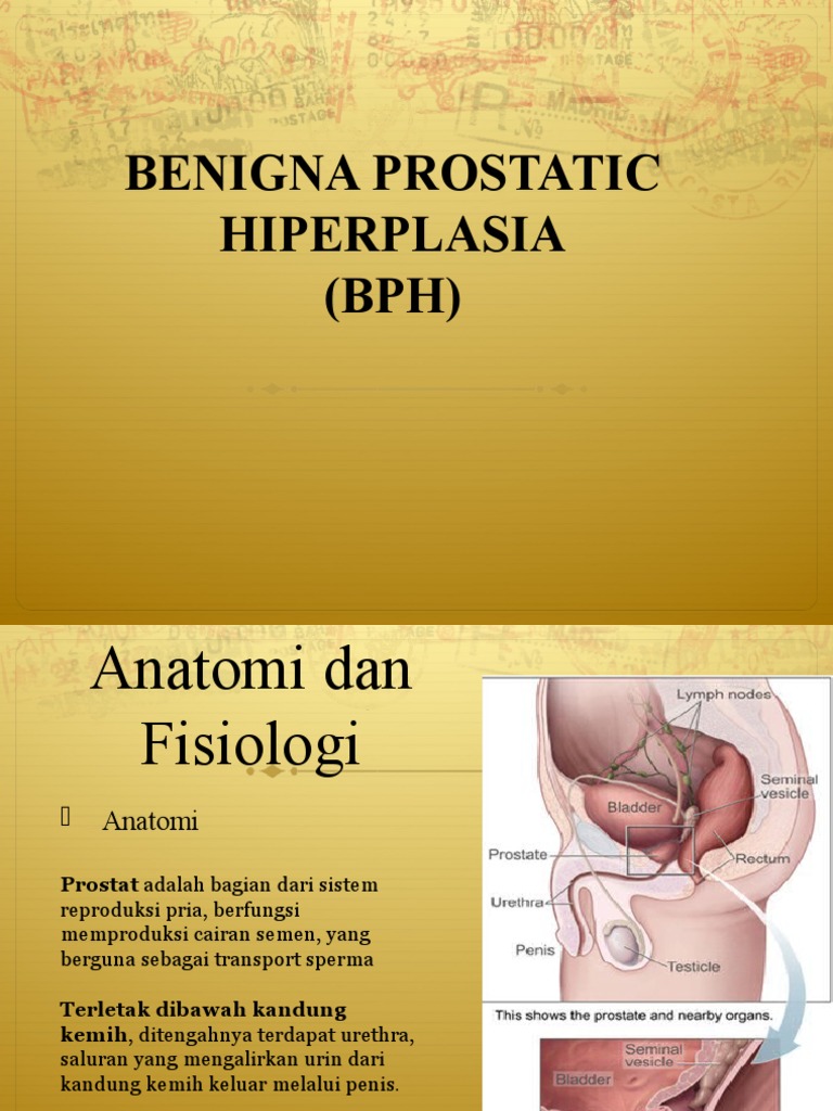 Askep BPH | PDF