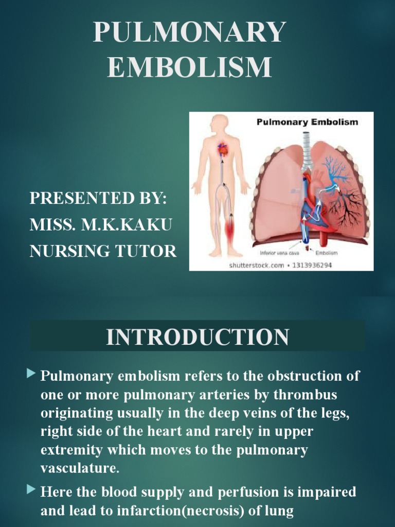 Pulmonary Embolism: Presented By: Miss. M.K.Kaku Nursing Tutor | PDF ...